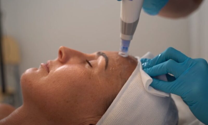 What Are Effective Anti-Aging Skin Treatments? Recommended By ...